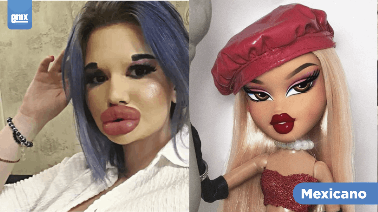 Mujer rellena sus labios más de 20 veces para lucir como... - El Mexicano